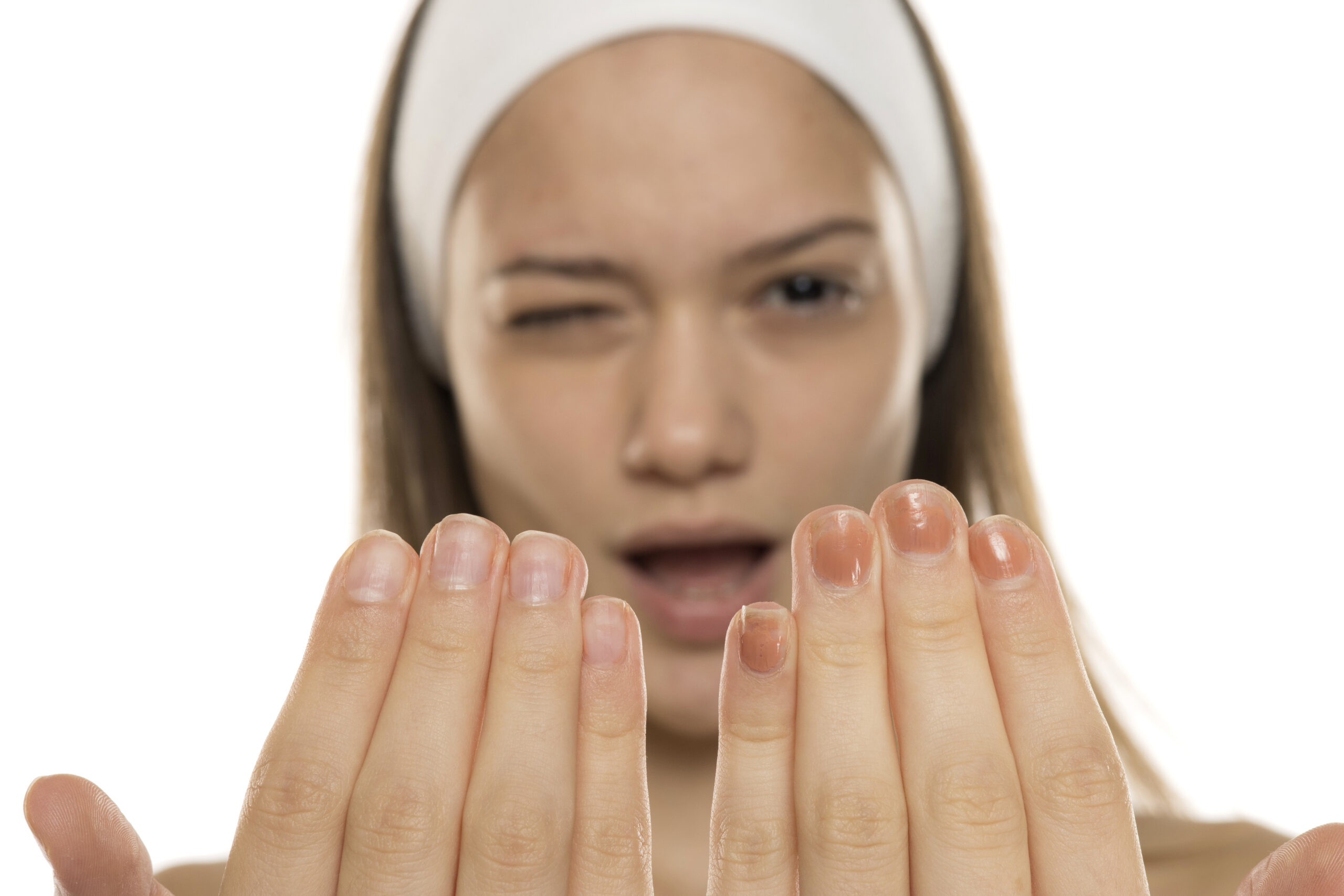 #25 Weekly Application: Acetone - Kemtrak